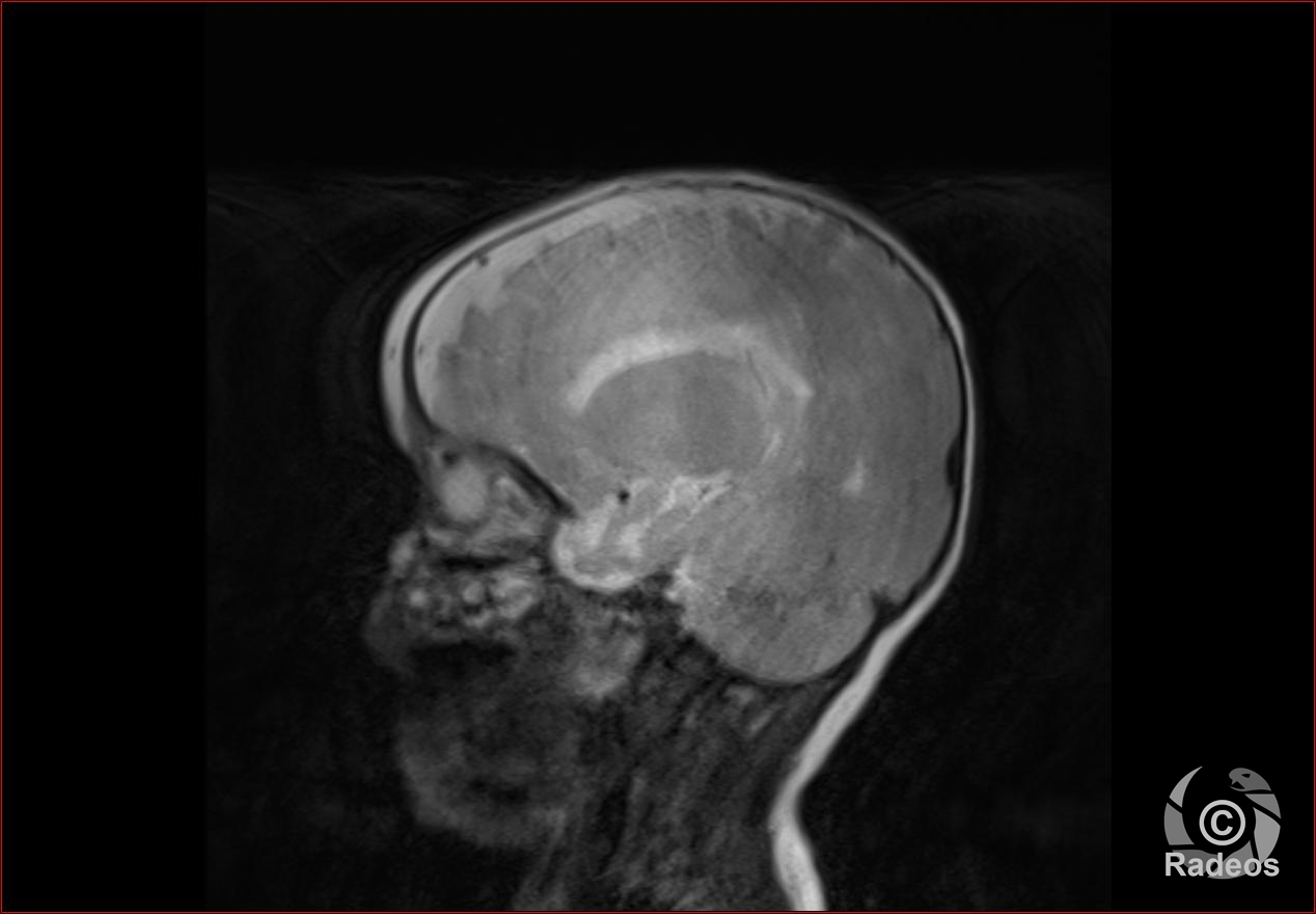 Tous les Cas Cliniques et e-learning en Radiologie et Imagerie Médicale ...