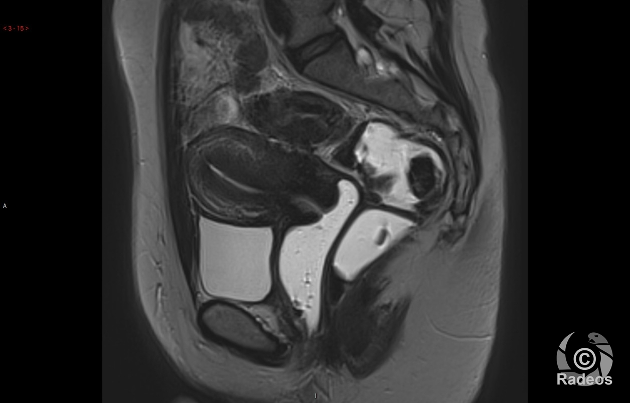 Tous les Cas Cliniques et e-learning en Radiologie et Imagerie Médicale ...