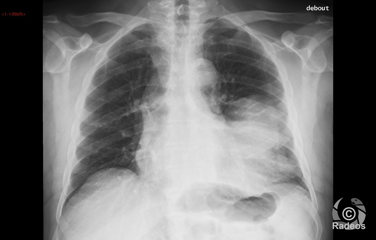 Tous les Cas Cliniques et e-learning en Radiologie et Imagerie Médicale ...