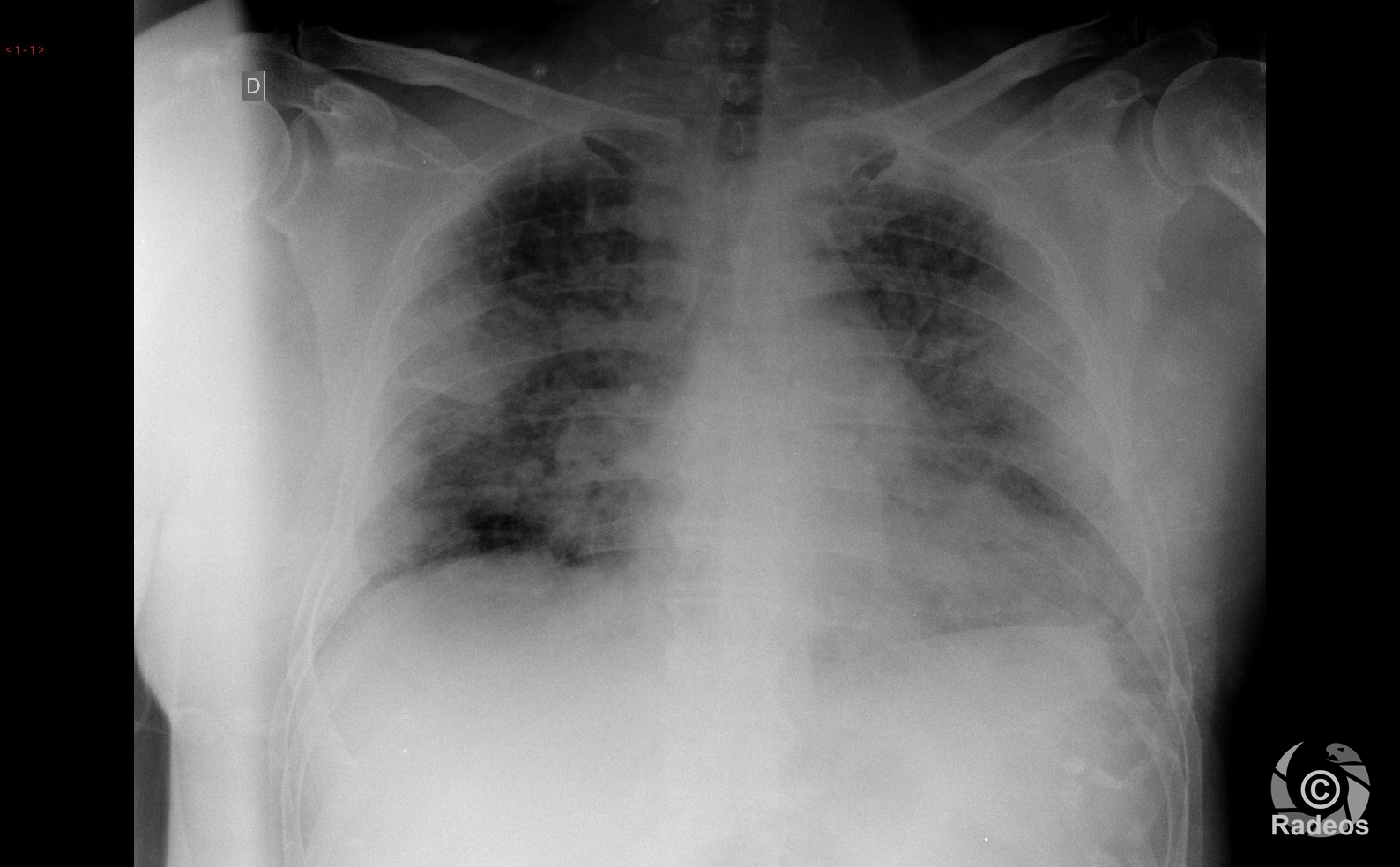 Tous les Cas Cliniques et e-learning en Radiologie et Imagerie Médicale ...