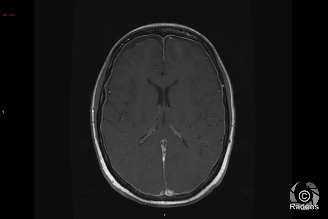 Tous les Cas Cliniques et e-learning en Radiologie et Imagerie Médicale ...