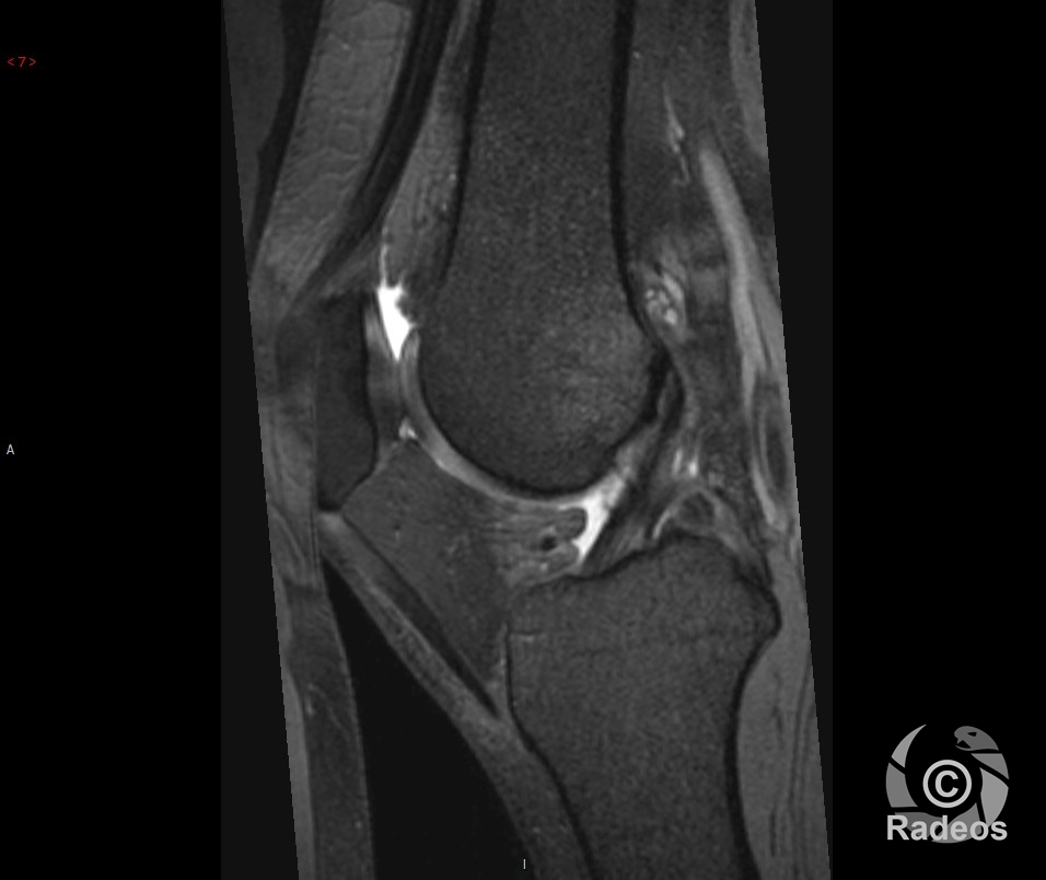 Tous les Cas Cliniques et e-learning en Radiologie et Imagerie Médicale ...