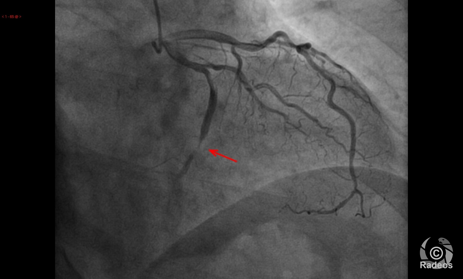Tous les Cas Cliniques et e-learning en Radiologie et Imagerie Médicale ...