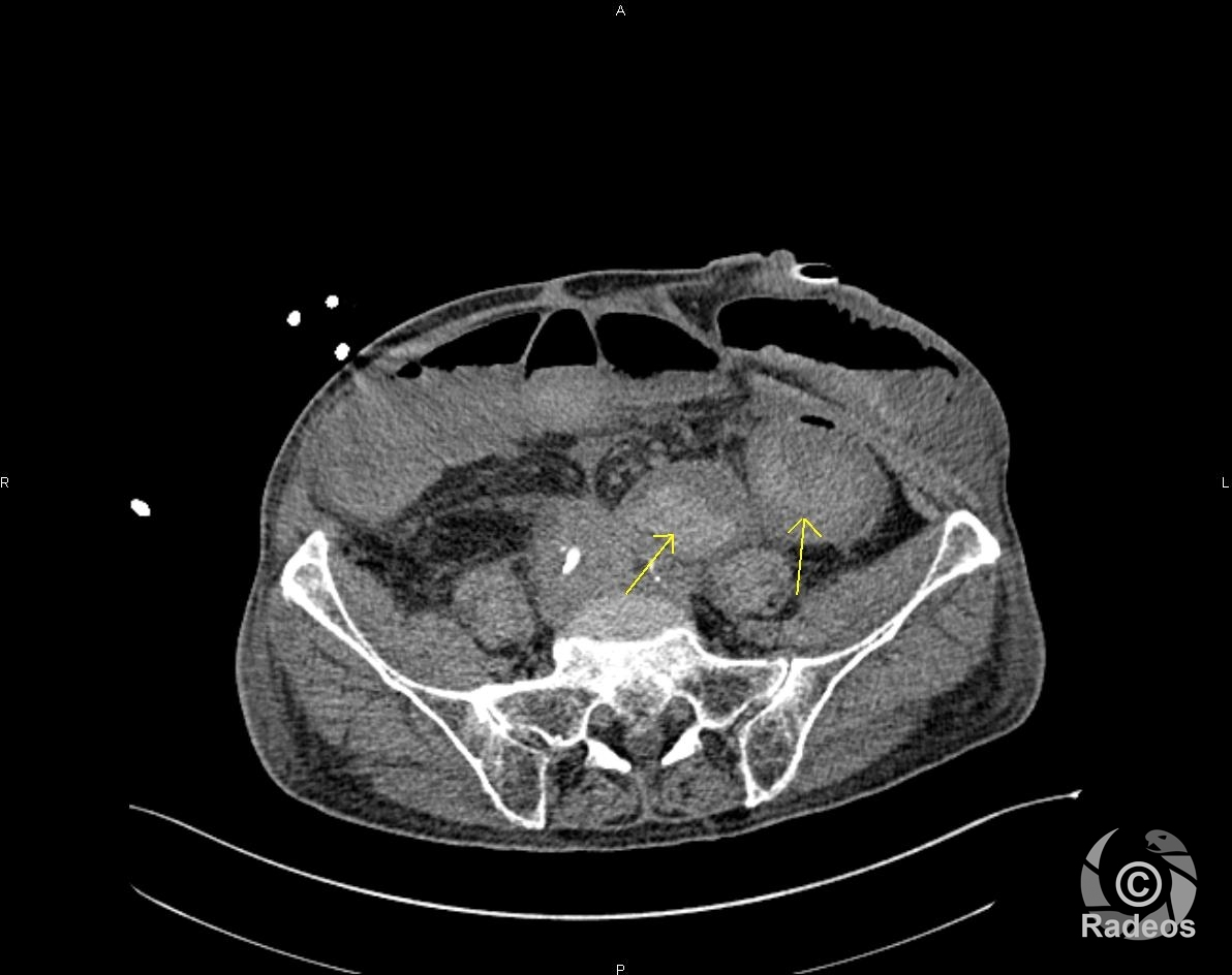 Tous les Cas Cliniques et e-learning en Radiologie et Imagerie Médicale ...
