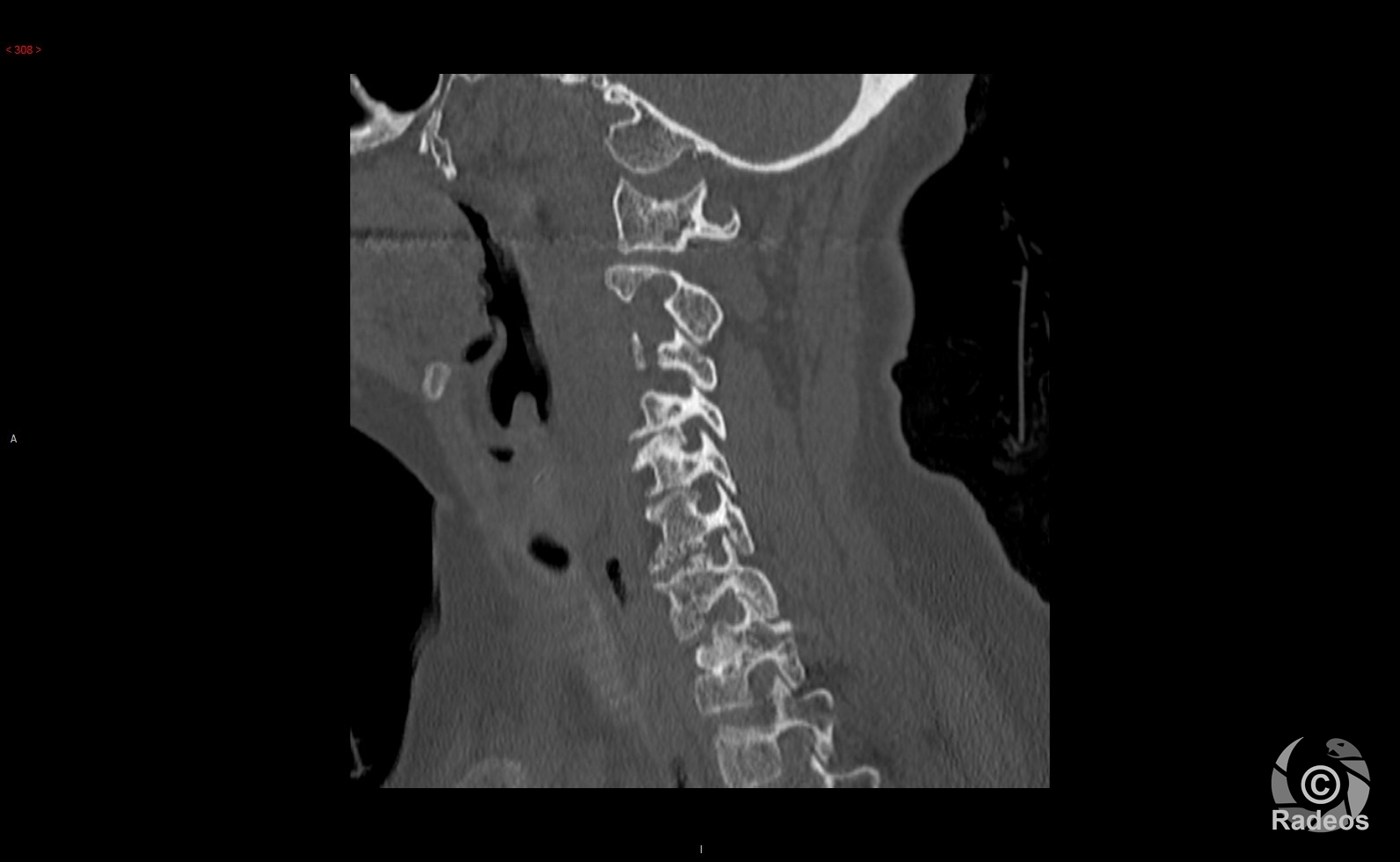 Tous les Cas Cliniques et e-learning en Radiologie et Imagerie Médicale ...