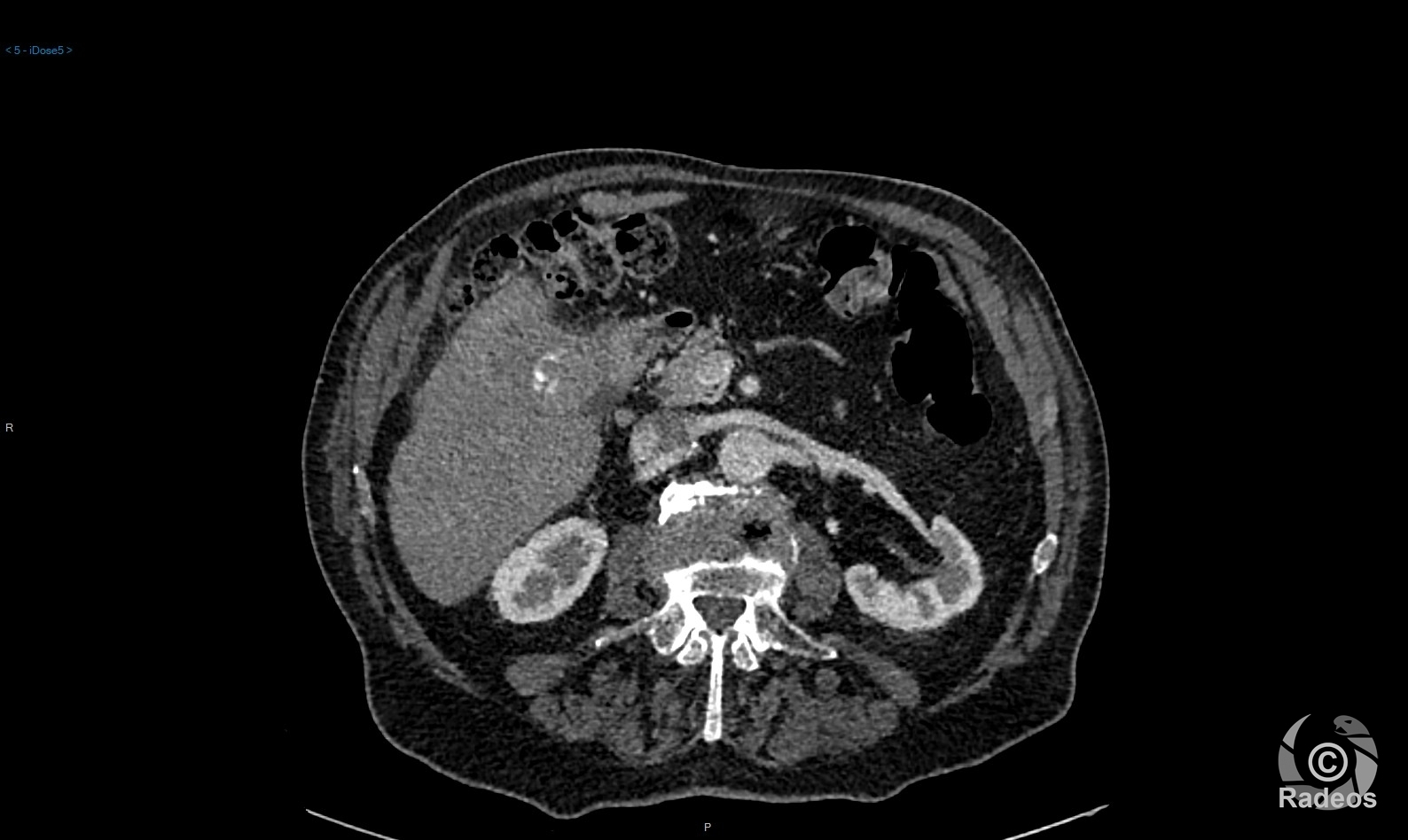 Tous les Cas Cliniques et e-learning en Radiologie et Imagerie Médicale ...