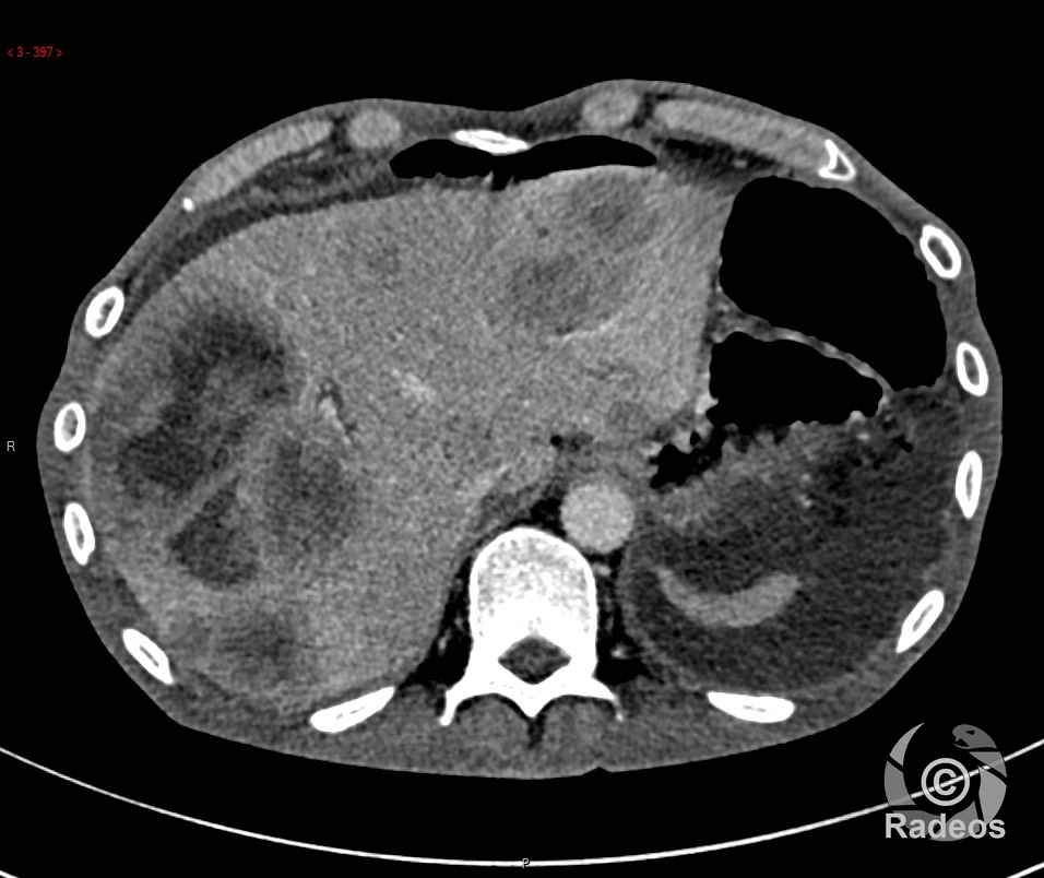 Tous les Cas Cliniques et e-learning en Radiologie et Imagerie Médicale ...