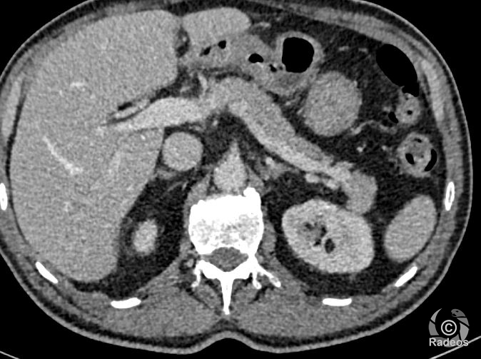 RADEOS Cas Cliniques et e-learning en Radiologie et Imagerie Médicale