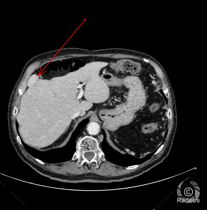 Tous les Cas Cliniques et e-learning en Radiologie et Imagerie Médicale ...
