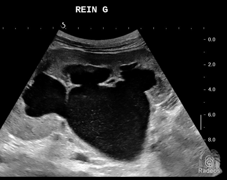 Tous les Cas Cliniques et e-learning en Radiologie et Imagerie Médicale ...