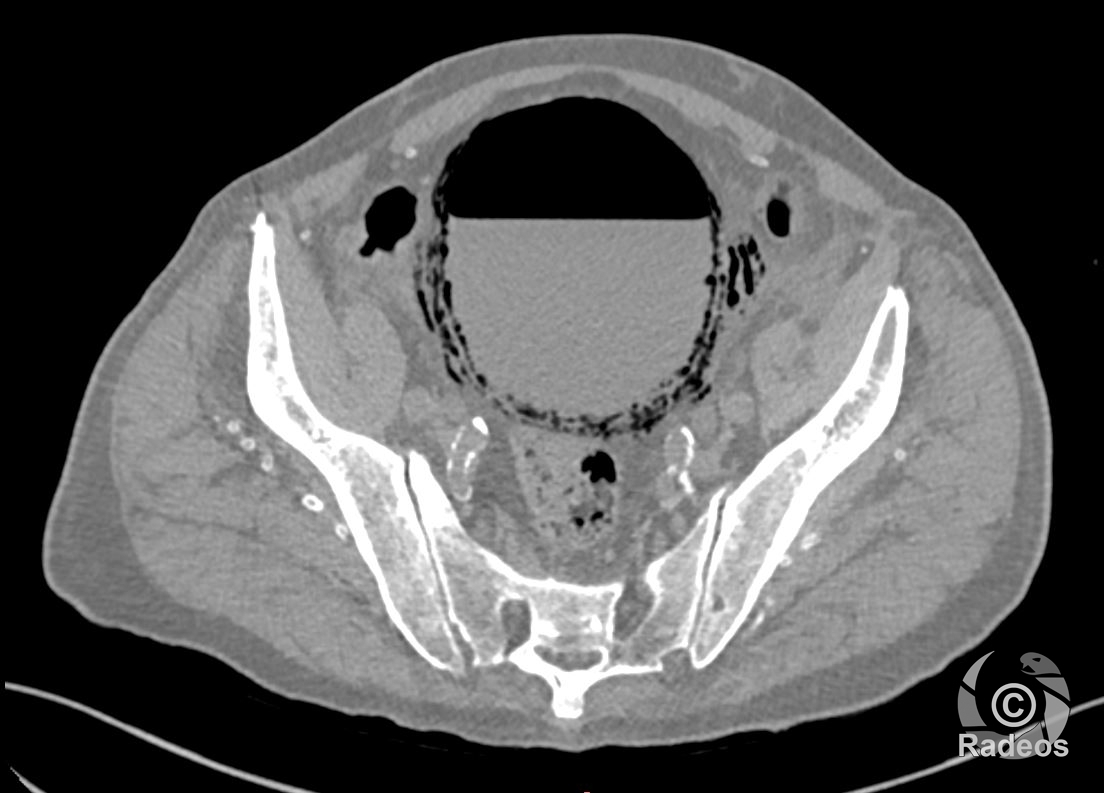Tous les Cas Cliniques et e-learning en Radiologie et Imagerie Médicale ...