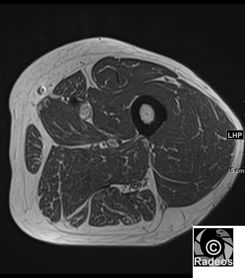 Tous les Cas Cliniques et e-learning en Radiologie et Imagerie Médicale ...