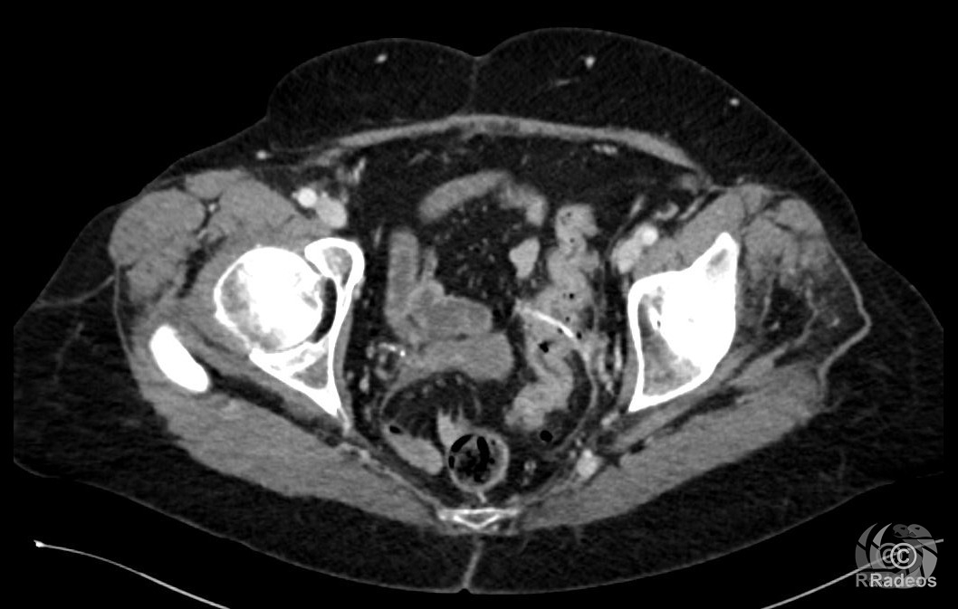 Tous les Cas Cliniques et e-learning en Radiologie et Imagerie Médicale ...