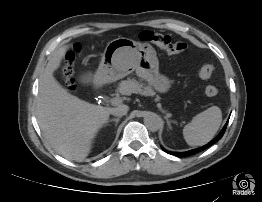 Tous les Cas Cliniques et e-learning en Radiologie et Imagerie Médicale ...