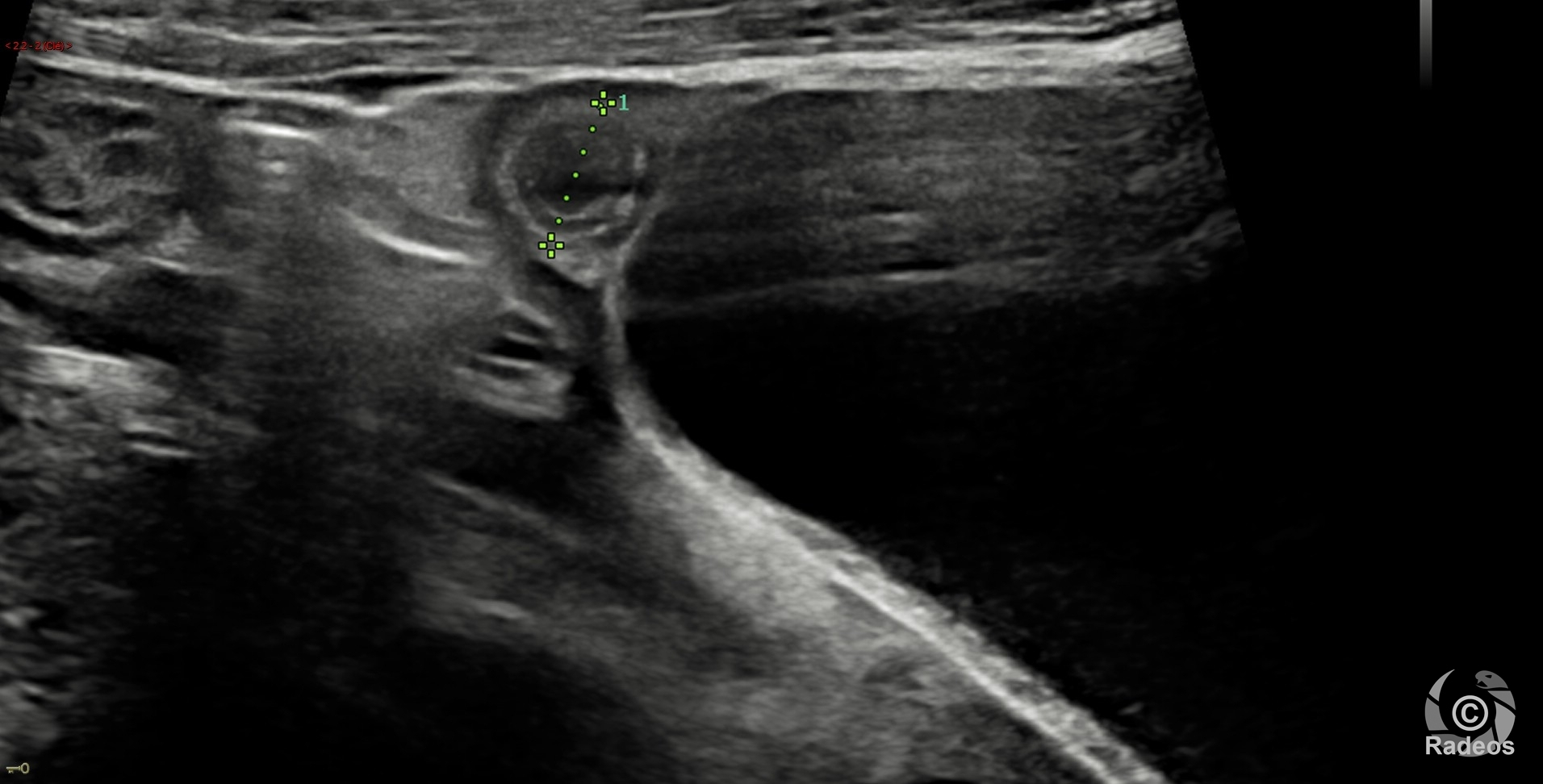 Tous les Cas Cliniques et e-learning en Radiologie et Imagerie Médicale ...
