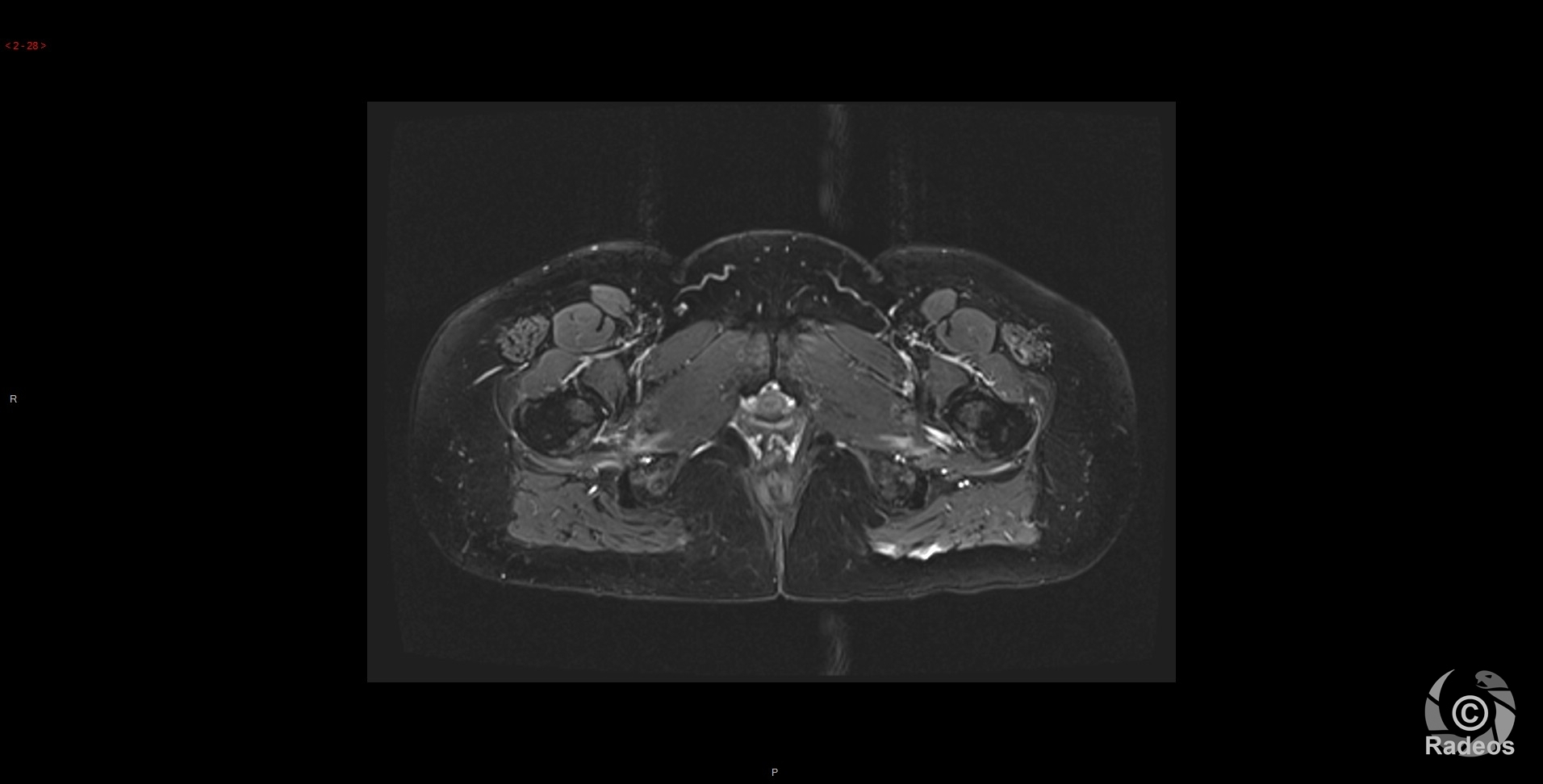 Tous les Cas Cliniques et e-learning en Radiologie et Imagerie Médicale ...