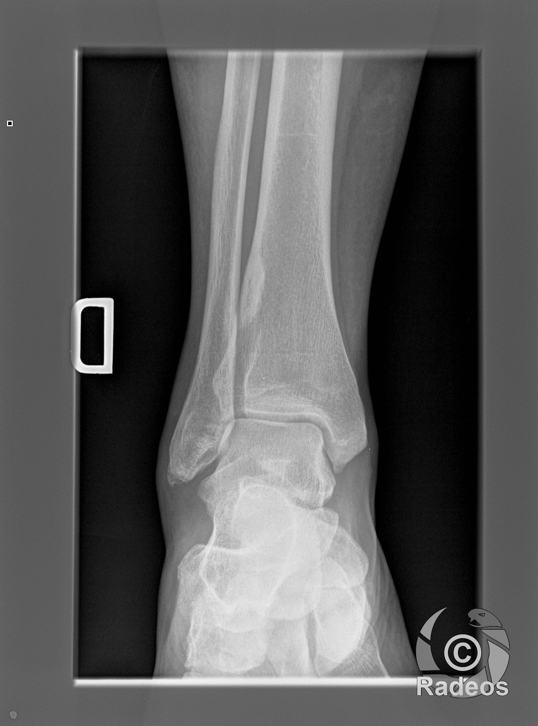 Tous les Cas Cliniques et e-learning en Radiologie et Imagerie Médicale ...