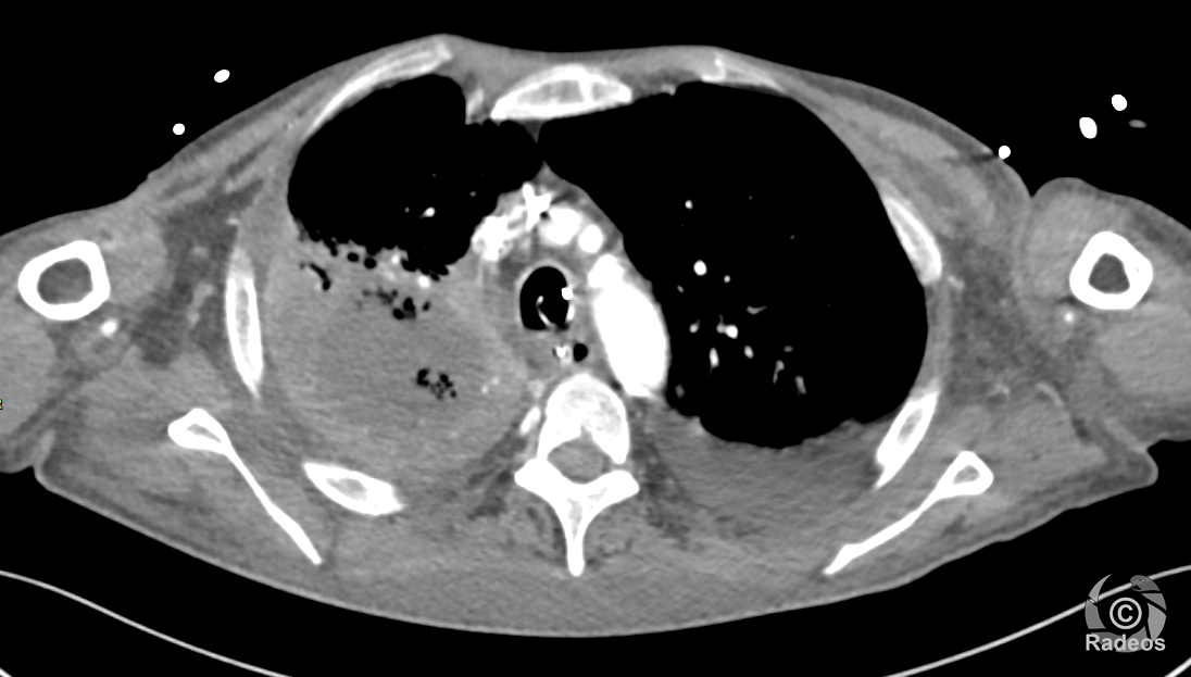 RADEOS Cas Cliniques et e-learning en Radiologie et Imagerie Médicale