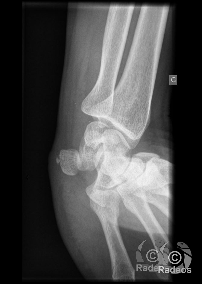 Tous les Cas Cliniques et e-learning en Radiologie et Imagerie Médicale ...