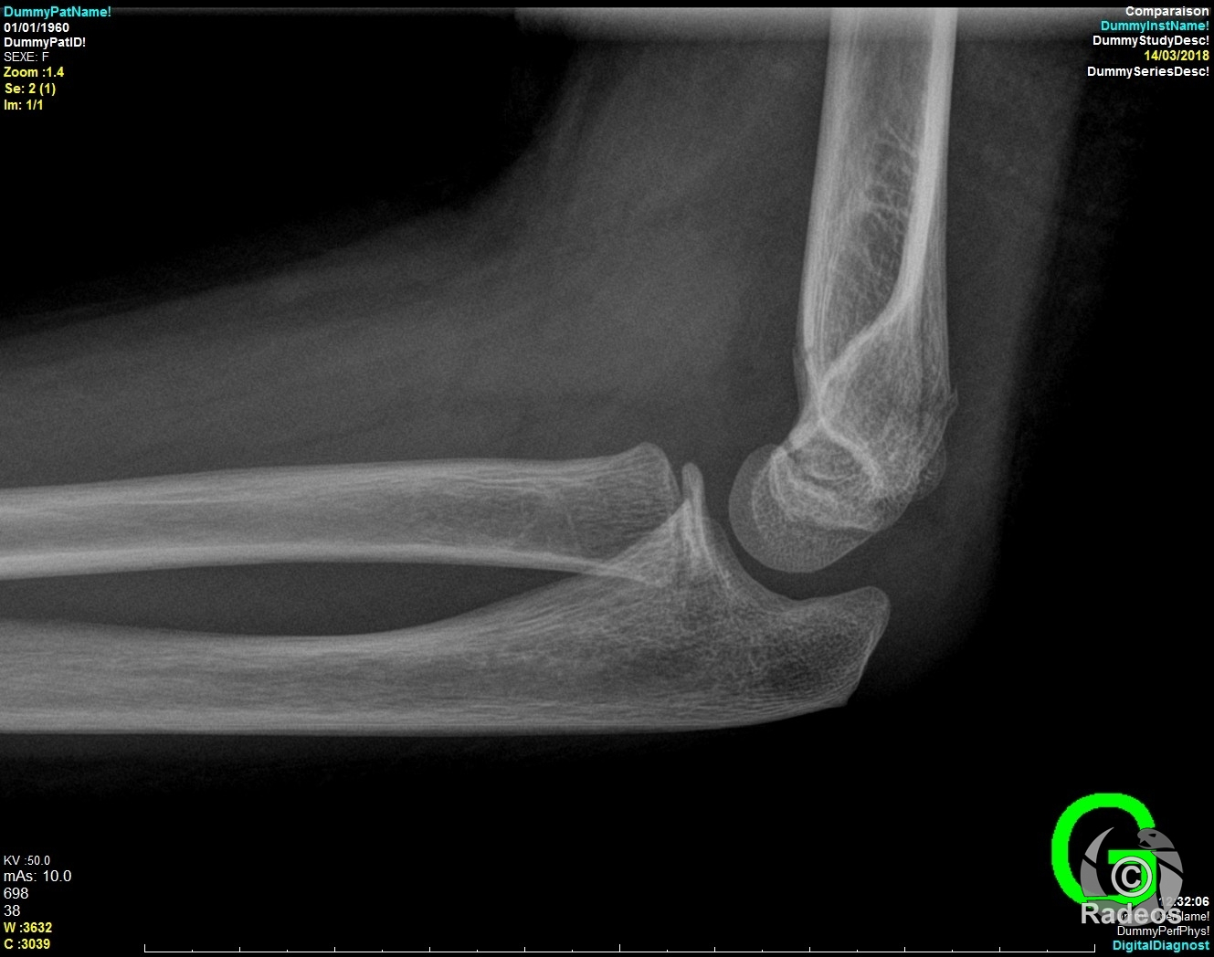 Tous les Cas Cliniques et e-learning en Radiologie et Imagerie Médicale ...