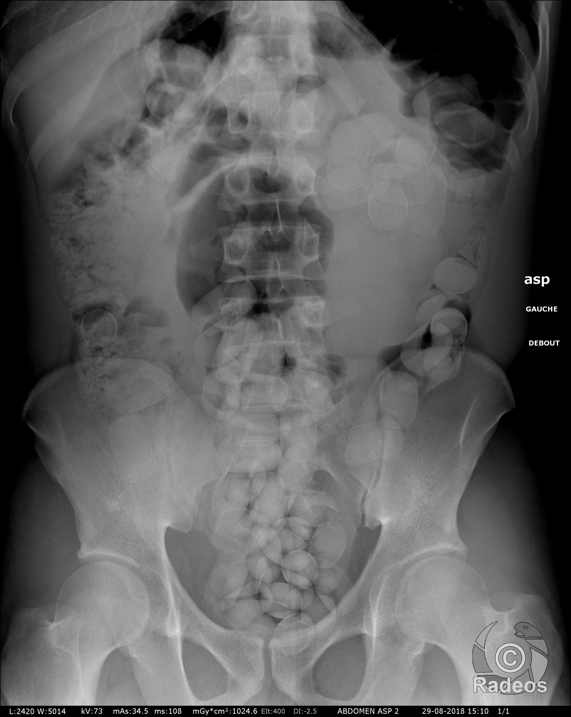 RADEOS Cas Cliniques et e-learning en Radiologie et Imagerie Médicale