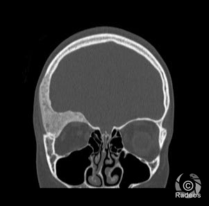 RADEOS Cas Cliniques et e-learning en Radiologie et Imagerie Médicale