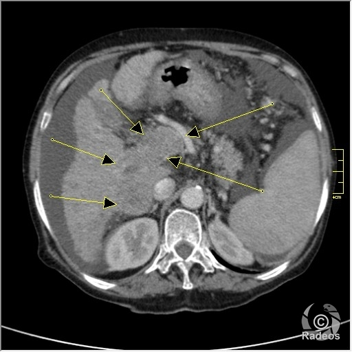 Tous les Cas Cliniques et e-learning en Radiologie et Imagerie Médicale ...