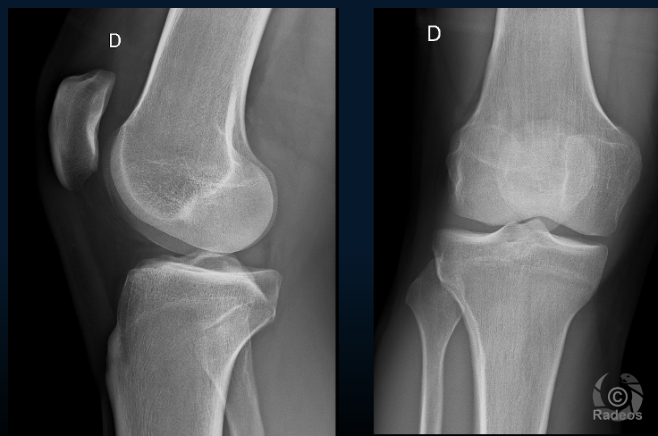 RADEOS Cas Cliniques et e-learning en Radiologie et Imagerie Médicale